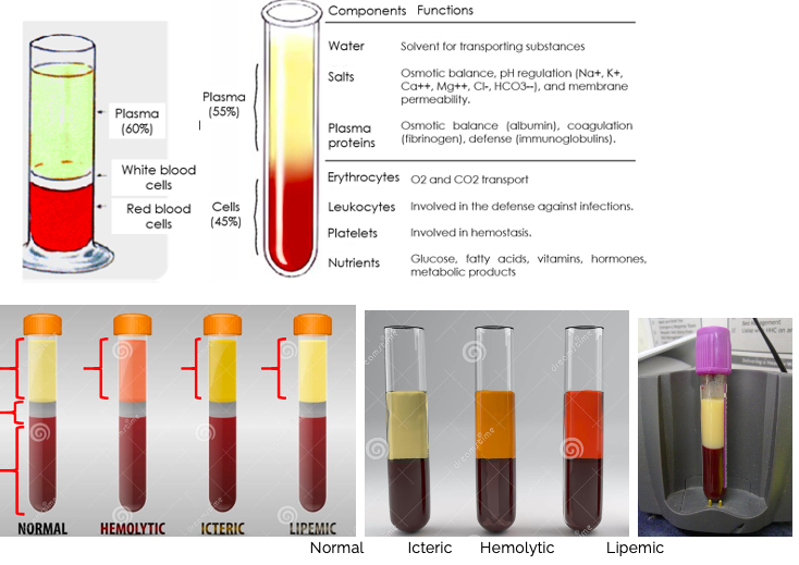 Clase digital 1. Basic introduction to hematology - Recursos Educativos ...
