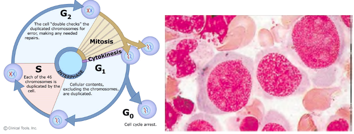 Clase digital 7. Megaloblastic anemia - Recursos Educativos Abiertos