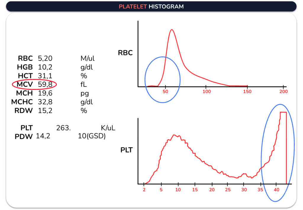 Digital class 4. Complete blood cell count - Recursos Educativos Abiertos