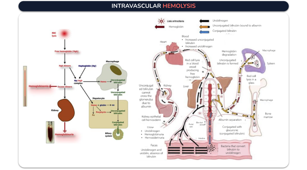 Digital class 8. Hemolytic anemia - Recursos Educativos Abiertos