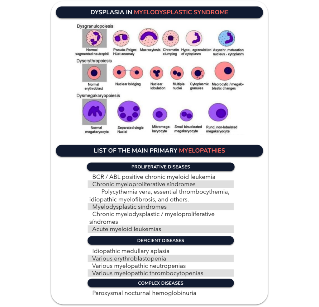 Digital class 10. Myelodysplastic syndromes - Recursos Educativos Abiertos